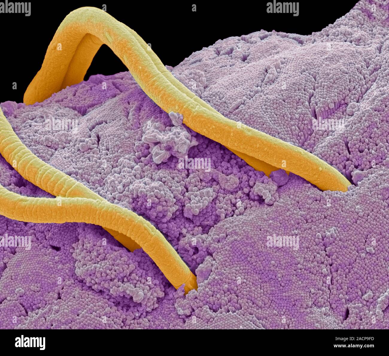 Threadworms in the gut. Coloured scanning electron micrograph (SEM ...