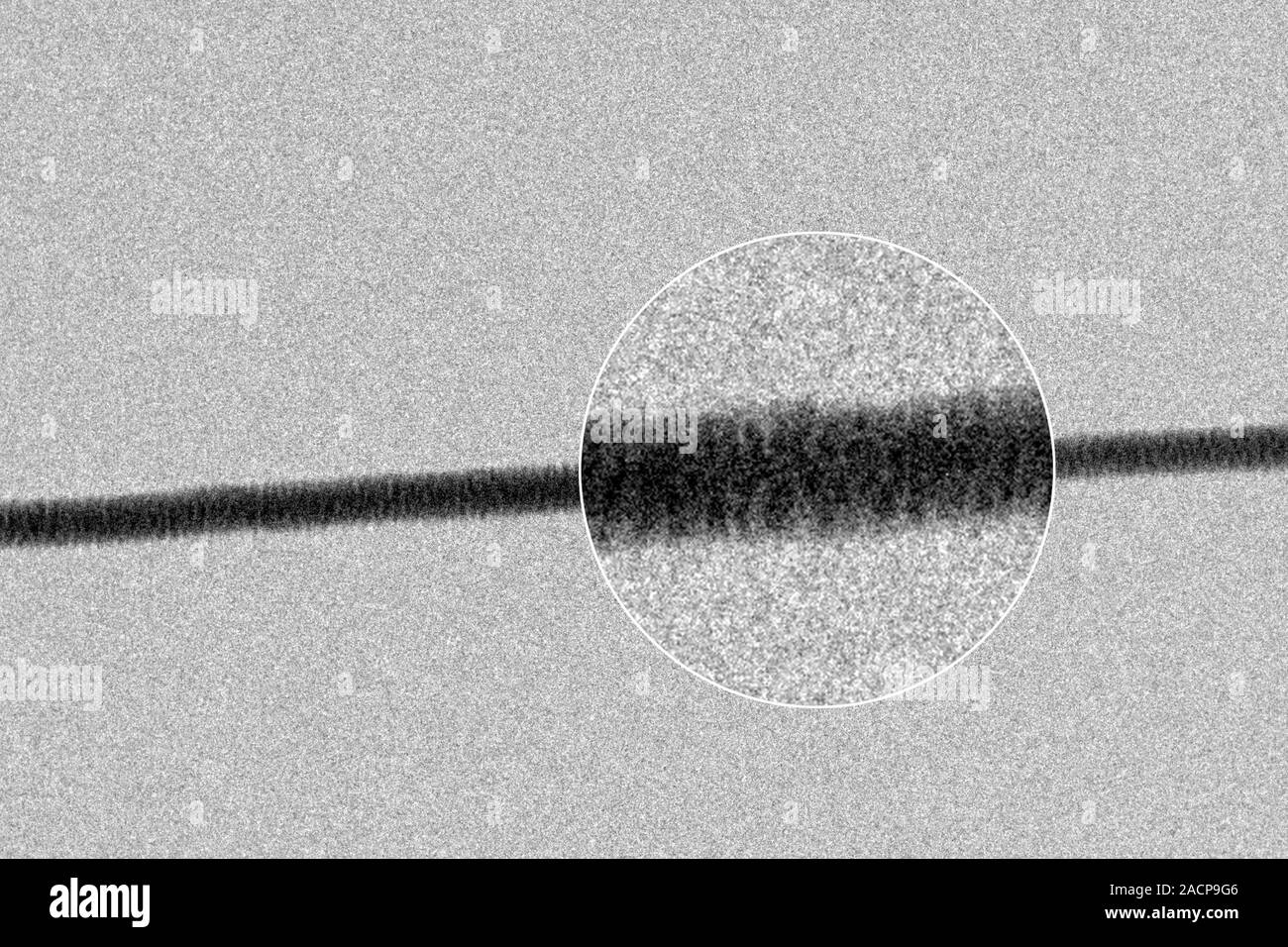 High-contrast direct DNA image. Transmission electron micrograph (TEM ...