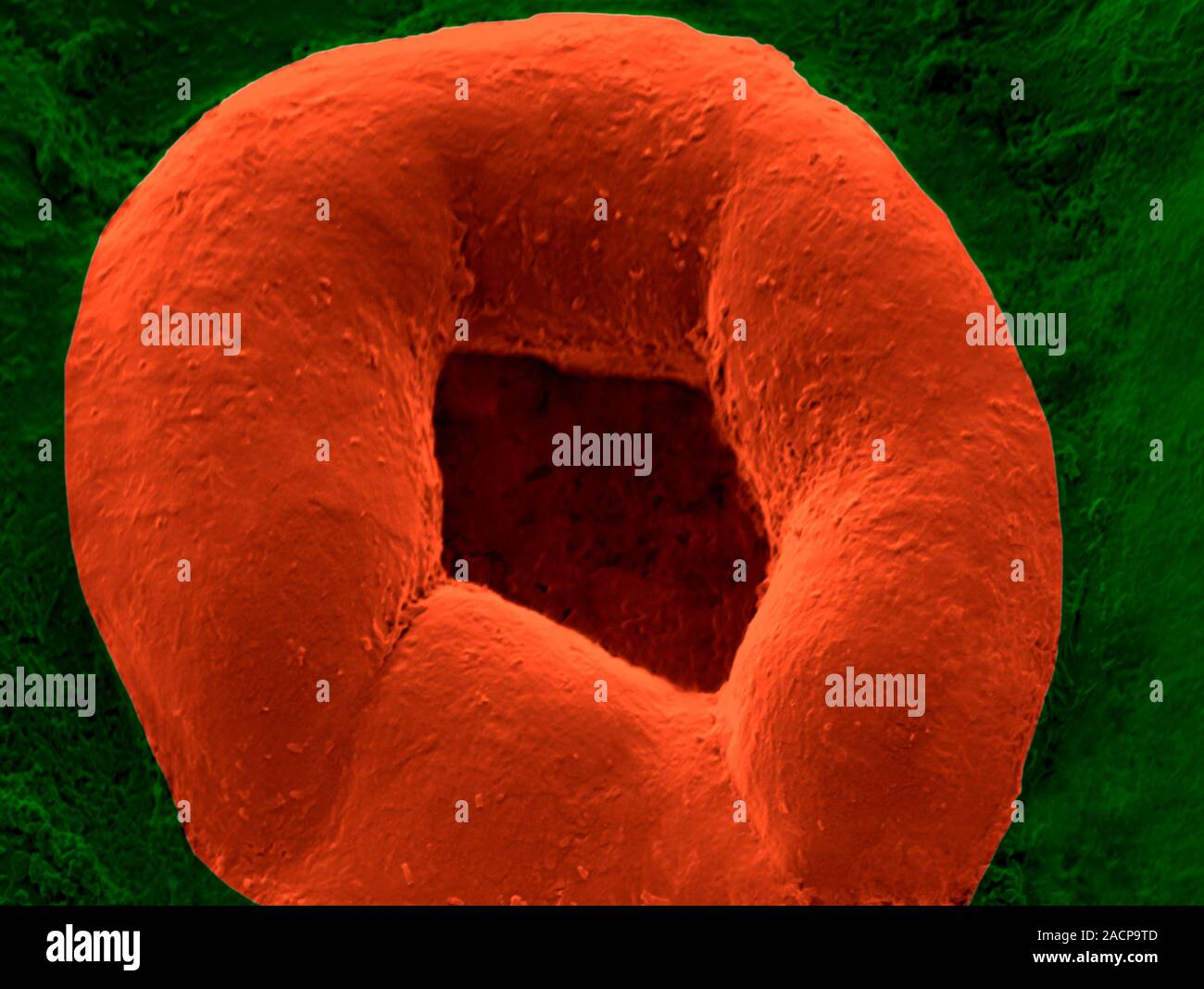 Pine needle stoma. Coloured environmental scanning electron micrograph ...