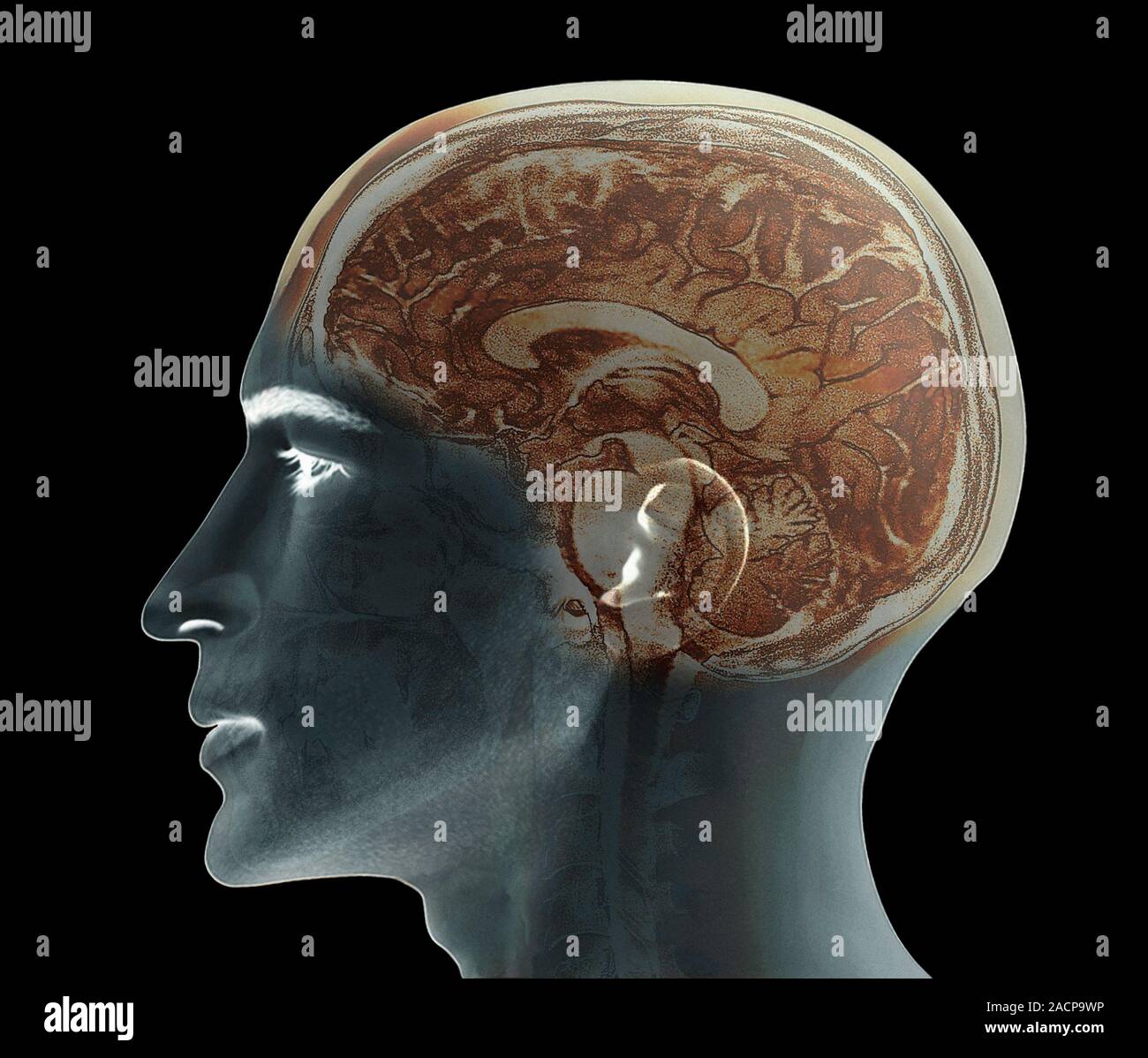 Normal human brain. Coloured magnetic resonance imaging (MRI) scan of a healthy human brain ...