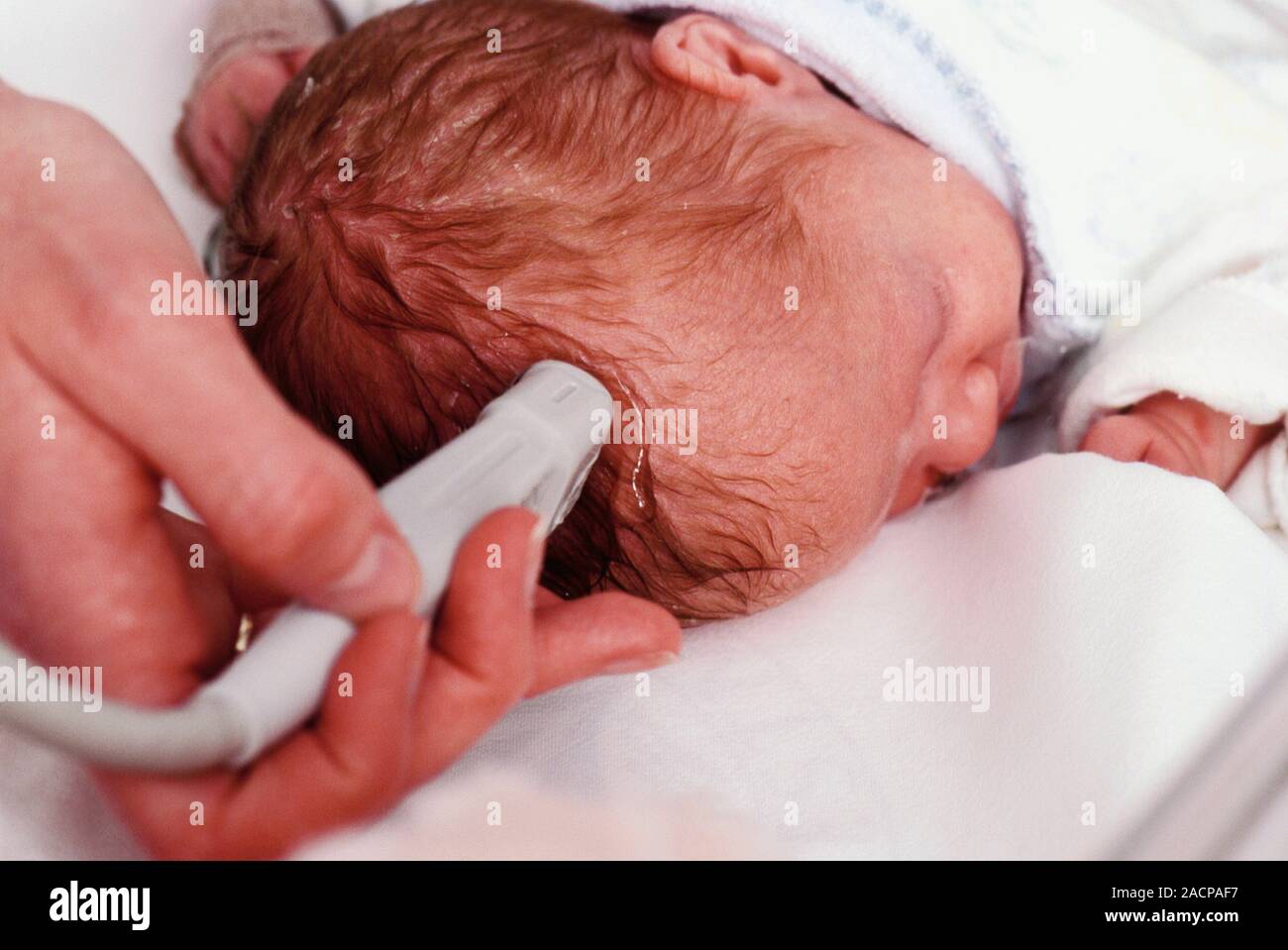 Newborn baby scan. Ultrasound scan of a newborn baby's head. The scan ...