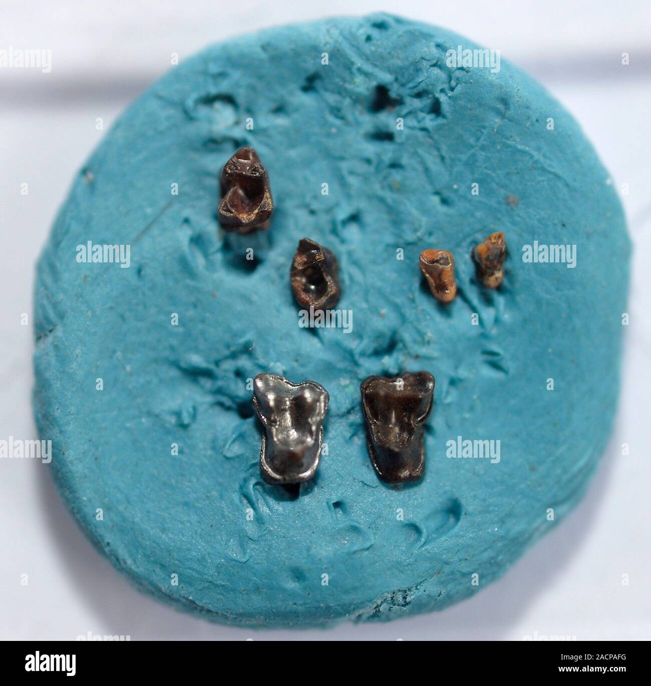 Fossil anthropoid teeth. Collection of fossil teeth from anthropoid ...