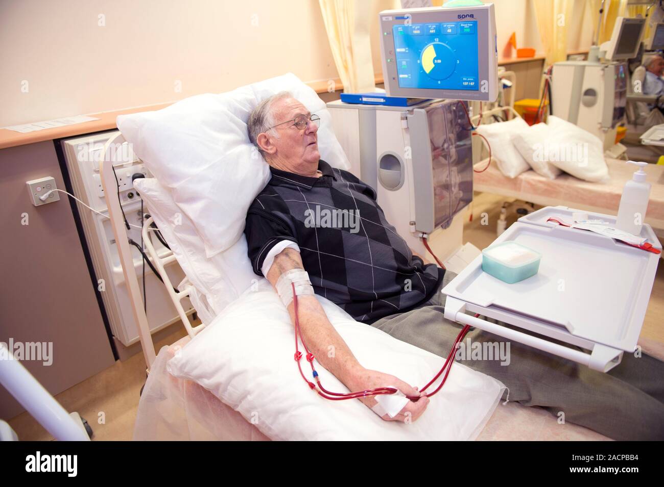 A 70 year old male patient with chronic renal failure undergoing kidney ...