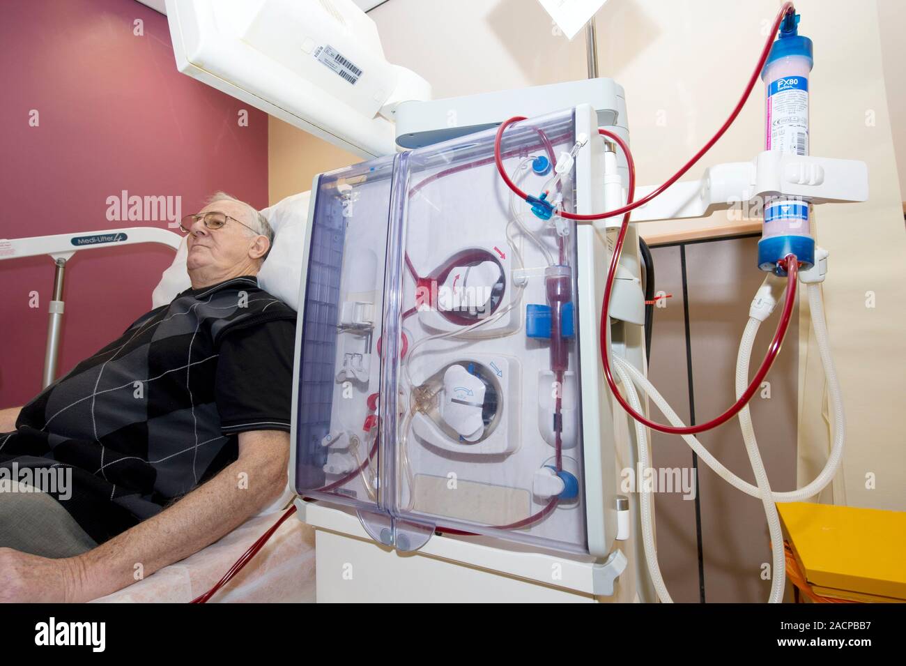 A 70 year old male patient with chronic renal failure undergoing kidney ...