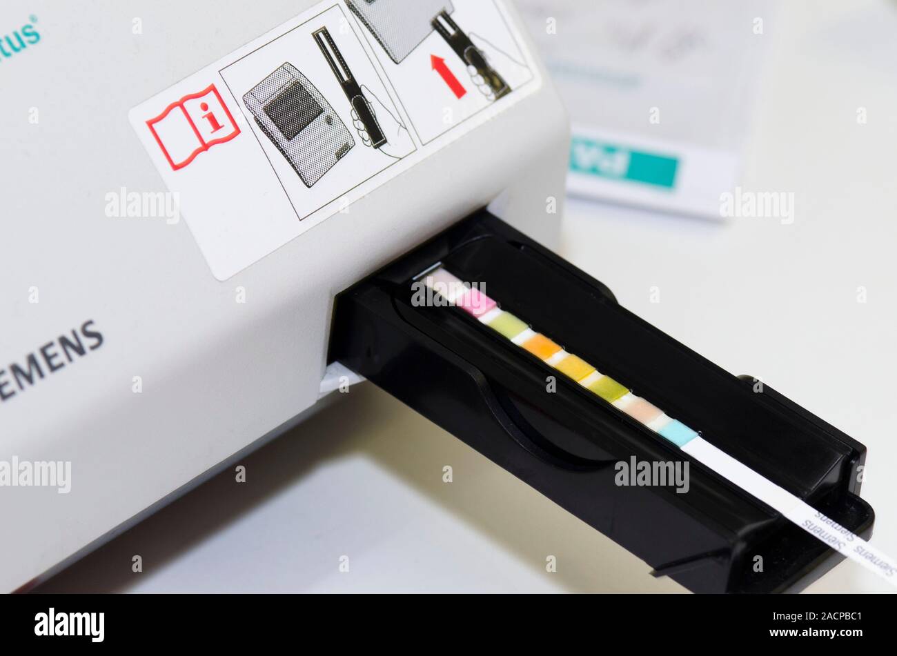 Urine dipstick analysis. A test strip dipped in urine is used to test ...