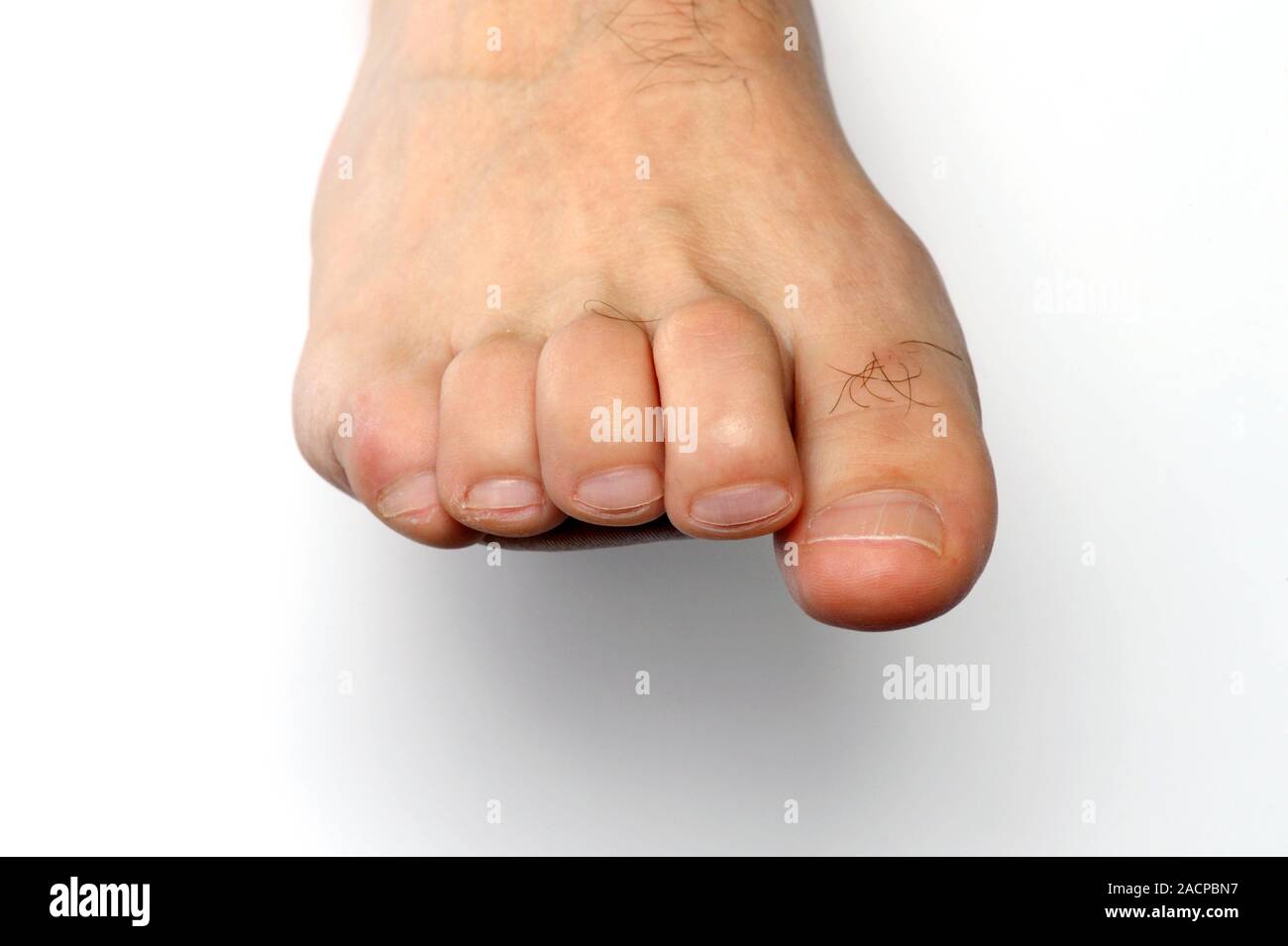 Not for use in Television Not for use in Television Retracted toes of a ...