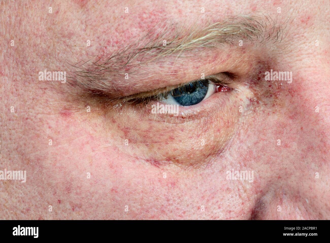 Not for use in Television Not for use in Television Close-up of a ...