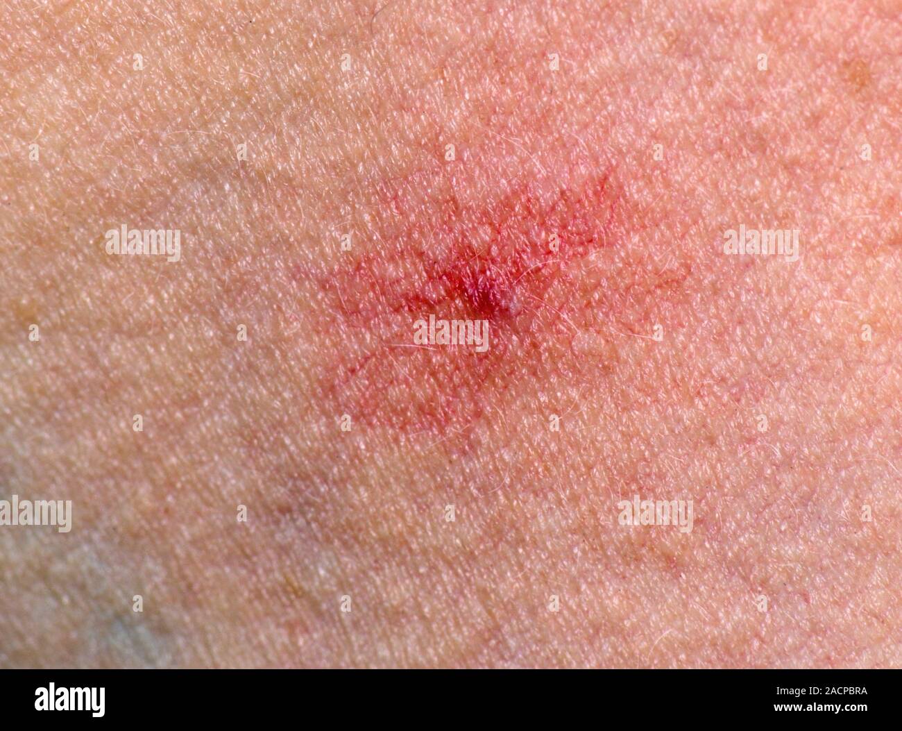 Not for use in Television Not for use in Television Close-up of a ...