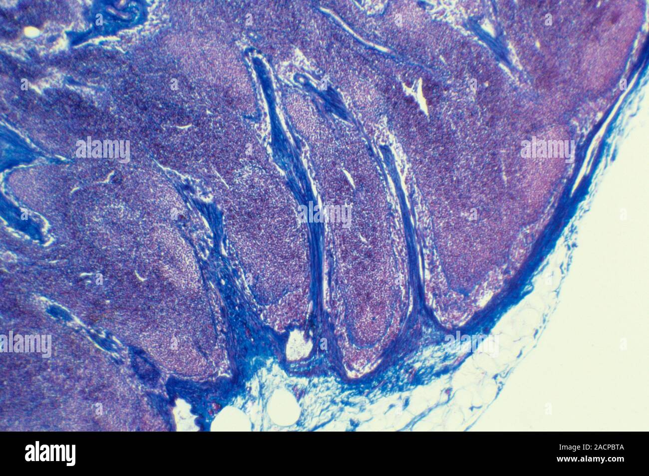 Lymph node. Light micrograph of a section through a lymph node. The ...