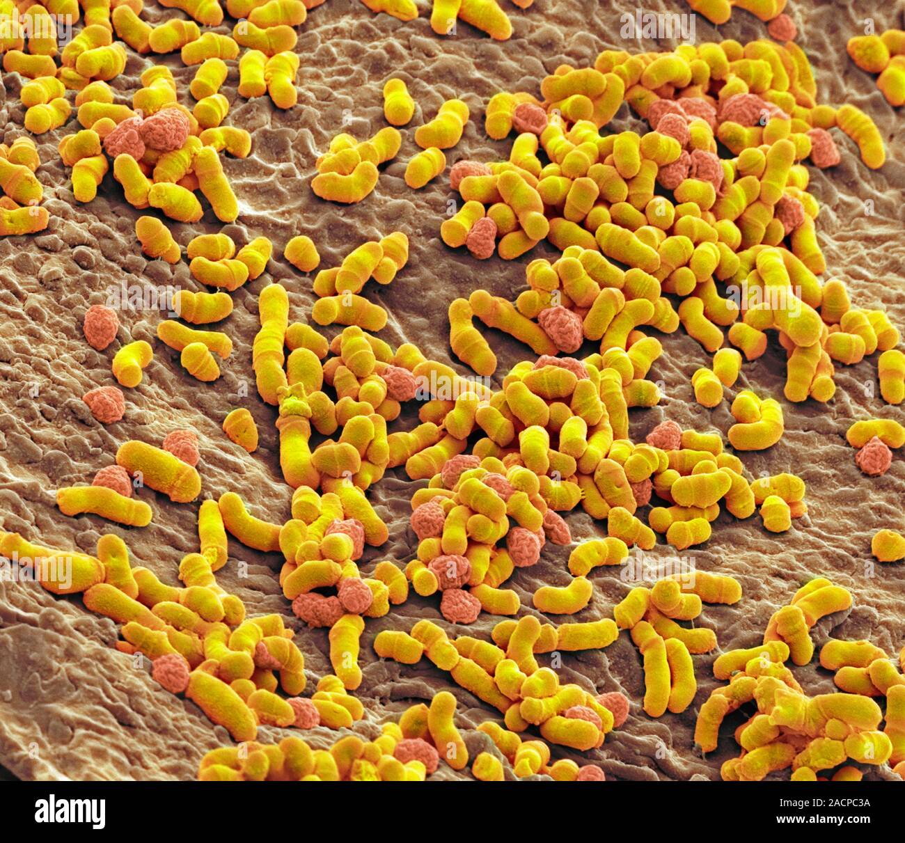 Athlete's foot fungus. Coloured scanning electron micrograph (SEM) of ...