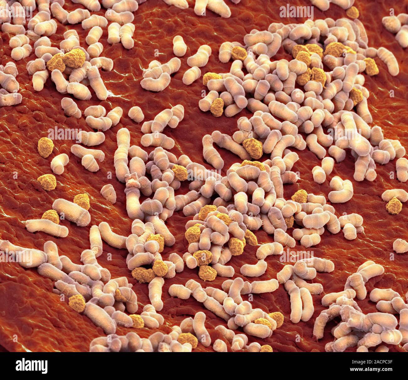 Athlete's foot fungus. Coloured scanning electron micrograph (SEM) of ...
