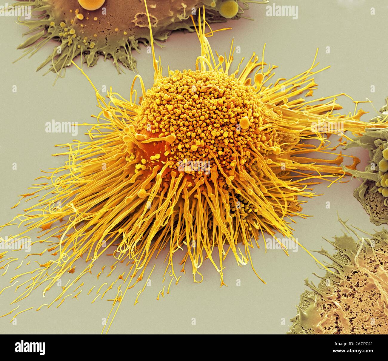 Activated macrophage. Coloured scanning electron micrograph (SEM) of an active macrophage white ...