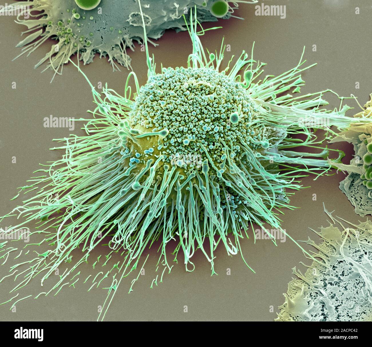 Activated macrophage. Coloured scanning electron micrograph (SEM) of an active macrophage white ...