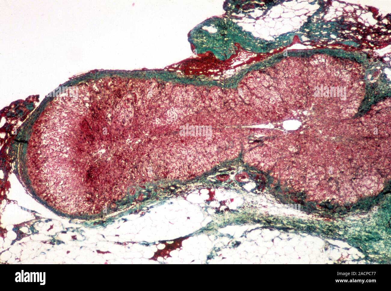 Adrenal cortex. Light micrograph of a section through a healthy adrenal ...