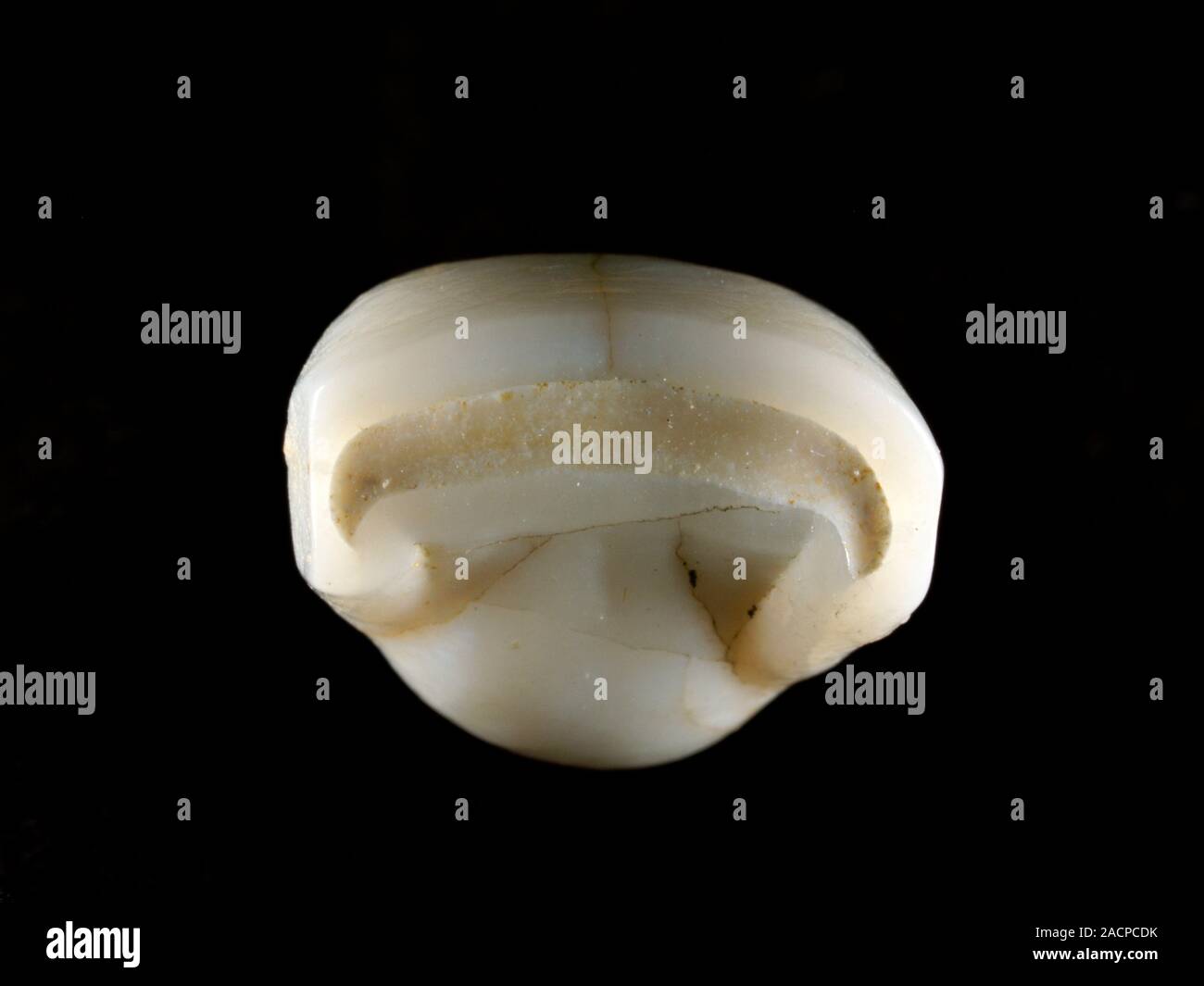 Homo heidelbergensis tooth. This incisor tooth is worn down with age ...
