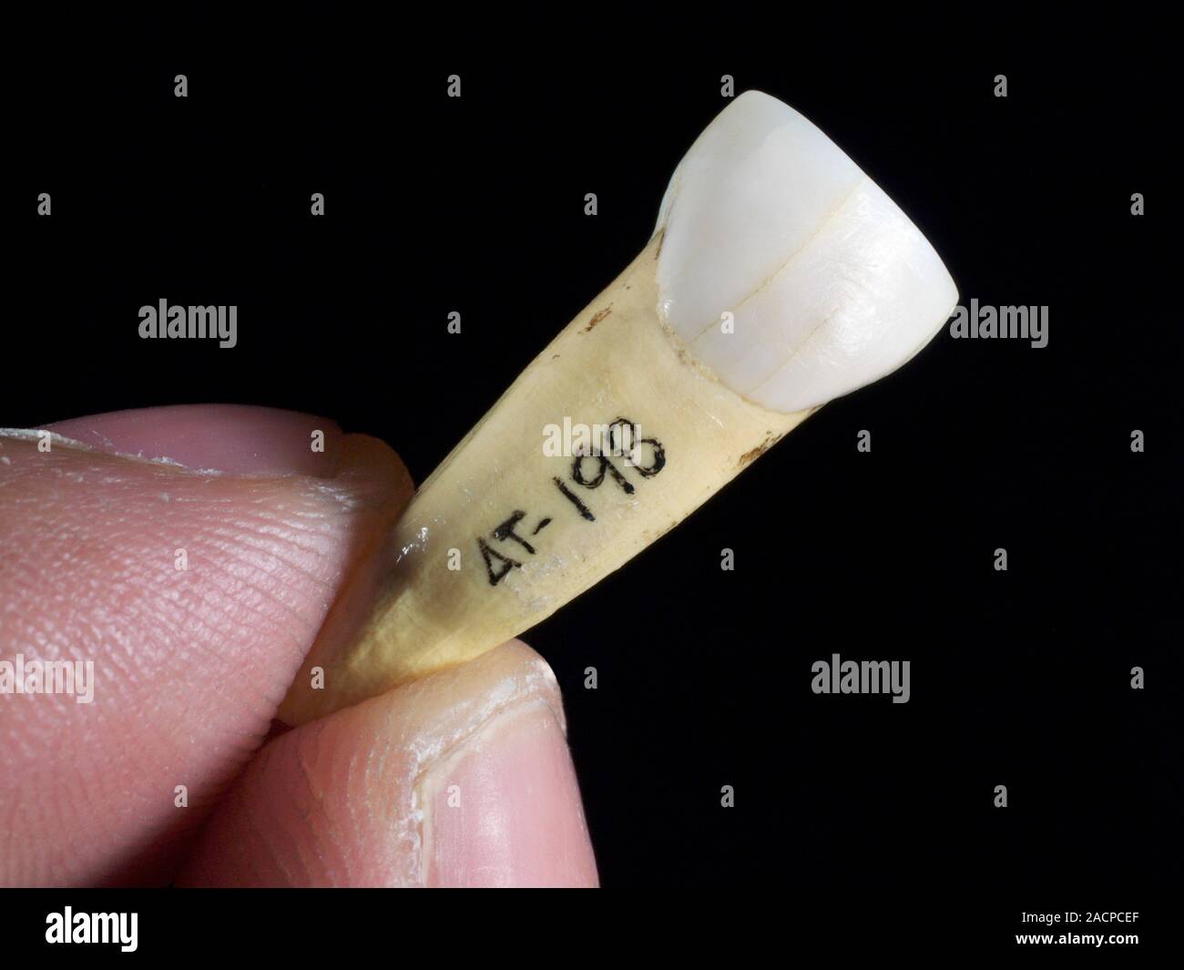 Homo heidelbergensis tooth. This fossil specimen is from the Sima de ...