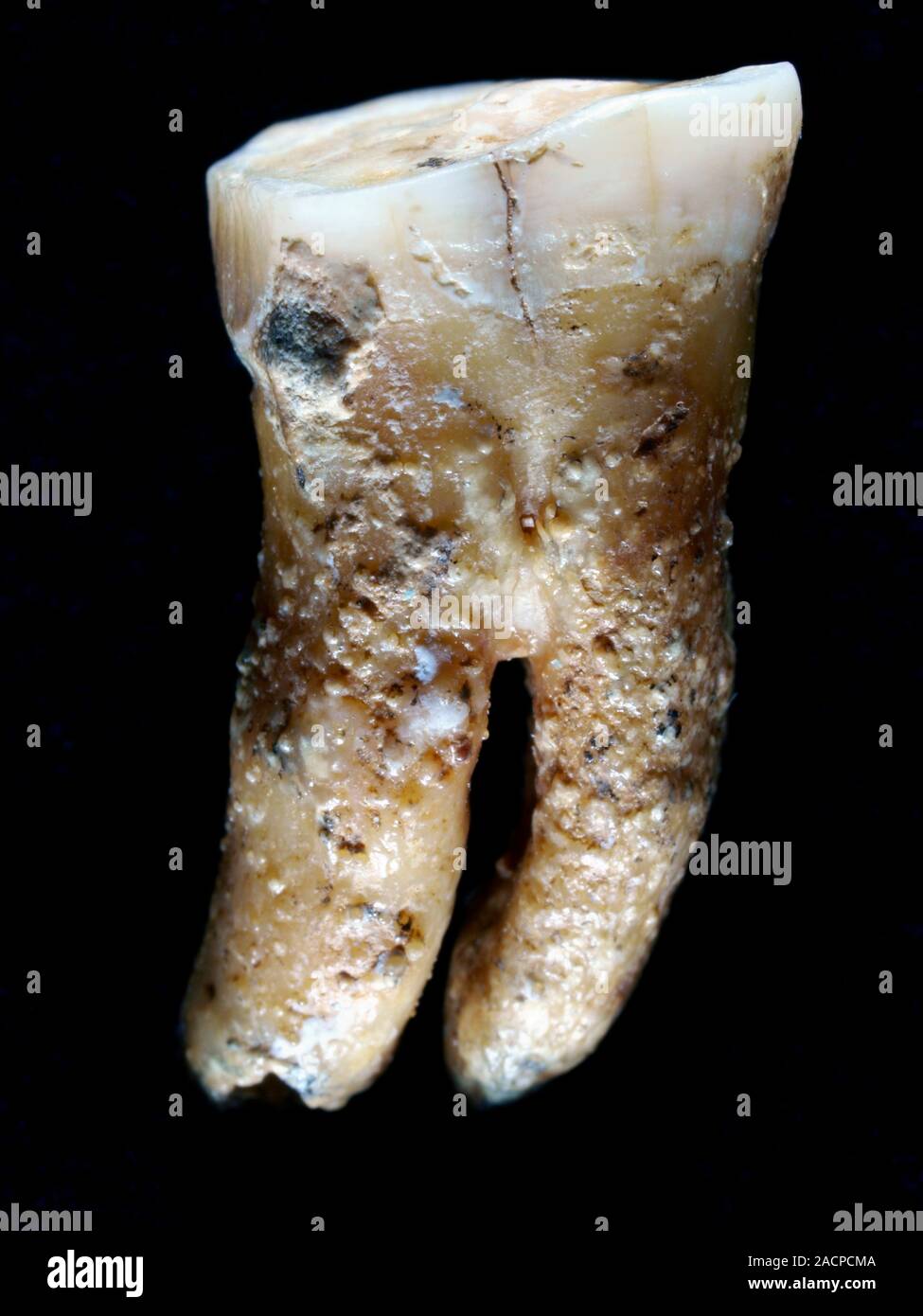 Neanderthal tooth. Neanderthals (Homo neanderthalensis) inhabited ...