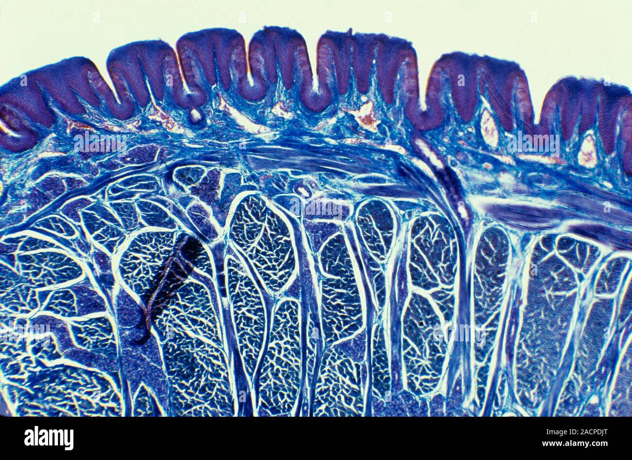 Tongue. Light micrograph of a section through healthy tongue tissue ...
