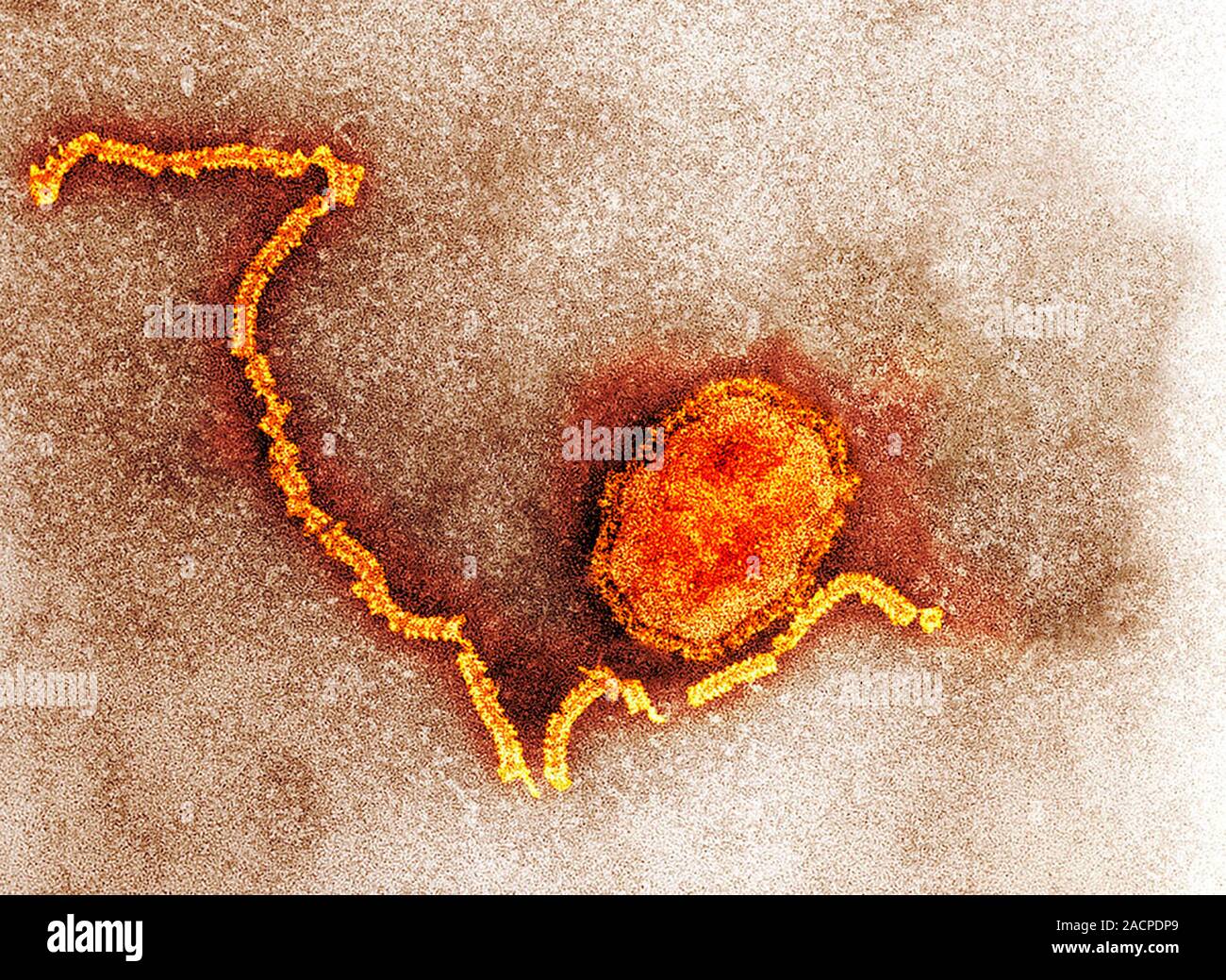 Measles virus particle, coloured transmission electron micrograph (TEM ...