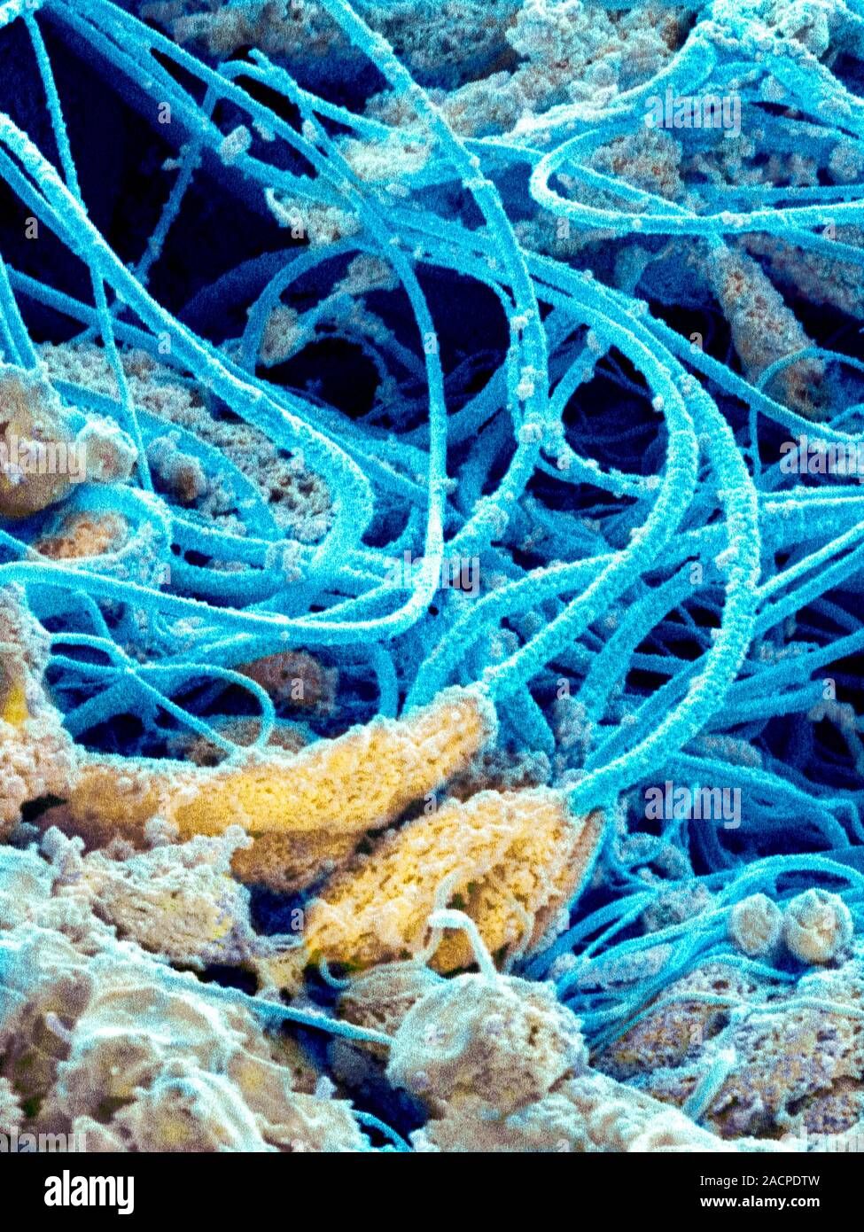 Sperm Production Coloured Scanning Electron Micrograph Sem Of Sperm