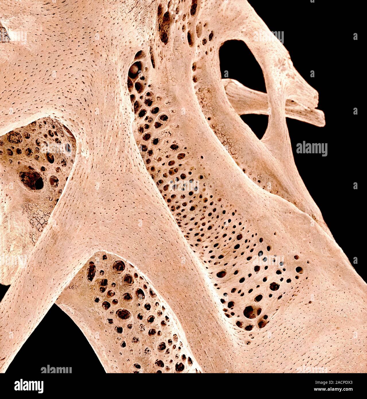 Fish bone. Coloured scanning electron micrograph (SEM) of a caudal ...