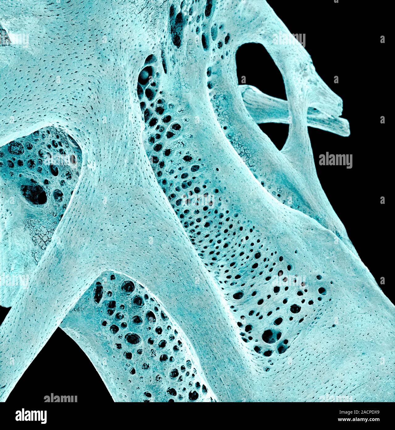 Fish bone. Coloured scanning electron micrograph (SEM) of a caudal ...