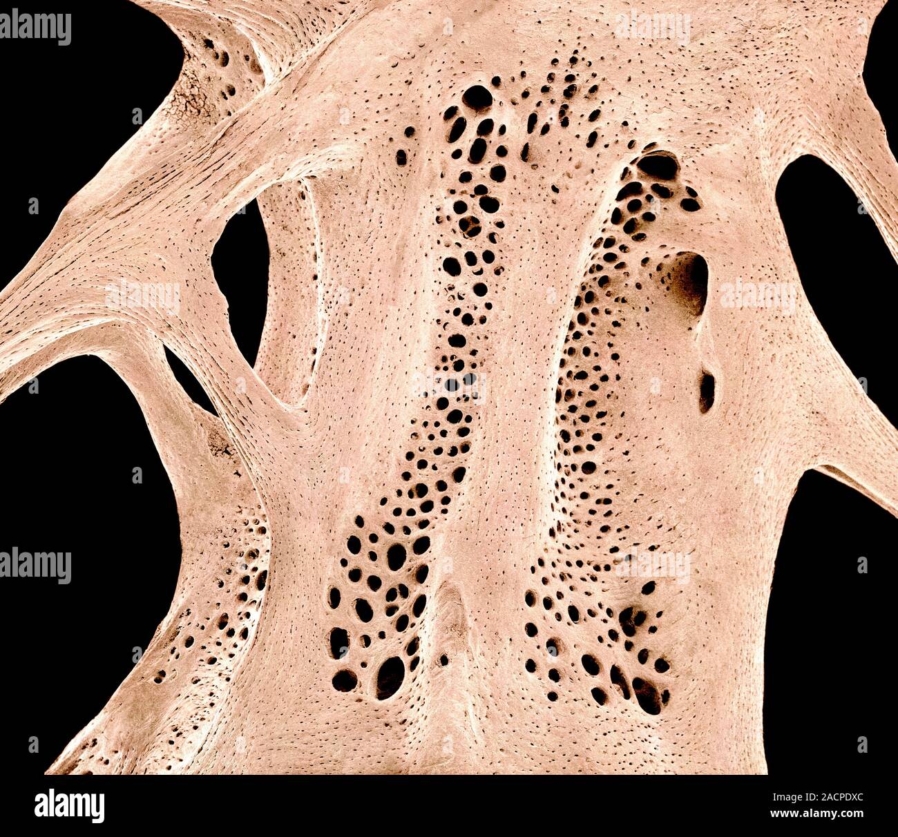 Fish bone. Coloured scanning electron micrograph (SEM) of a caudal ...