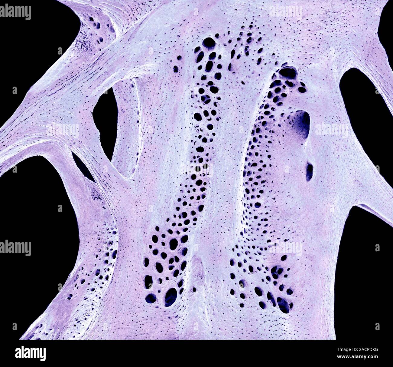 Fish bone. Coloured scanning electron micrograph (SEM) of a caudal ...