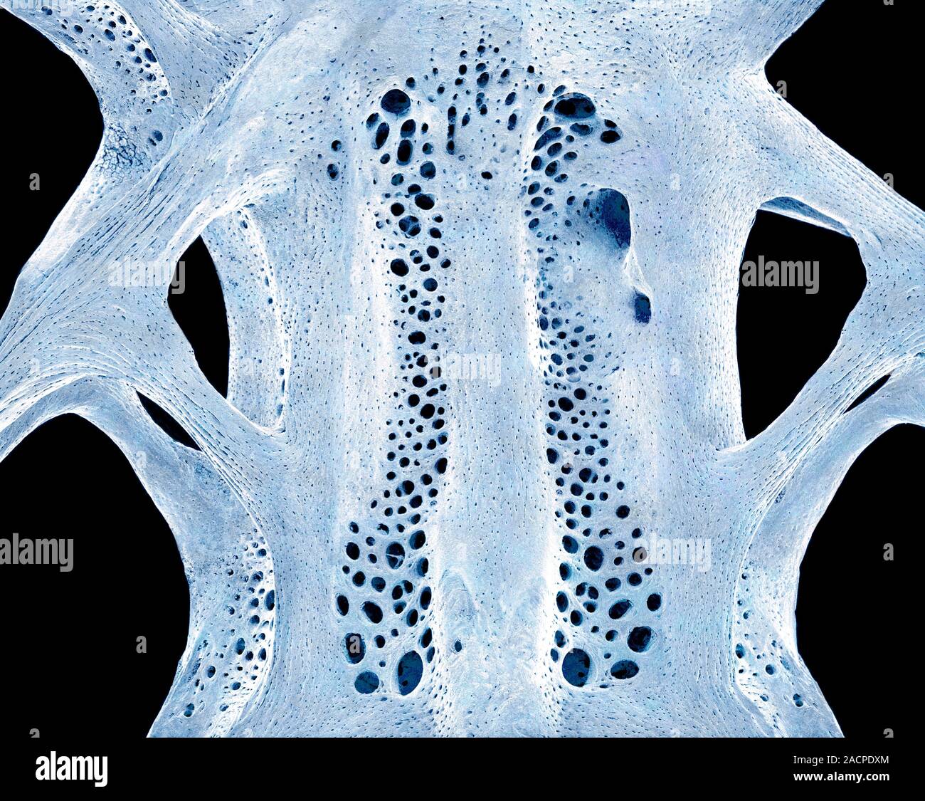 Fish bone. Coloured scanning electron micrograph (SEM) of a caudal ...