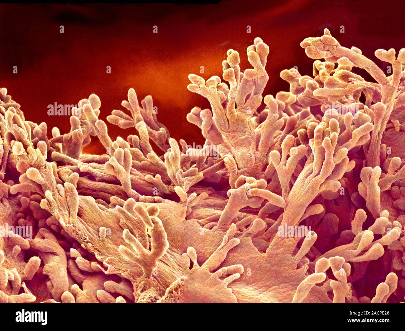Fish mouth lining. Coloured scanning electron micrograph of the lining ...