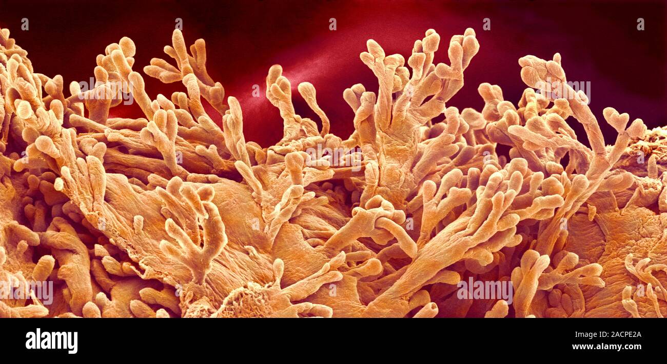 Fish mouth lining. Coloured scanning electron micrograph of the lining ...