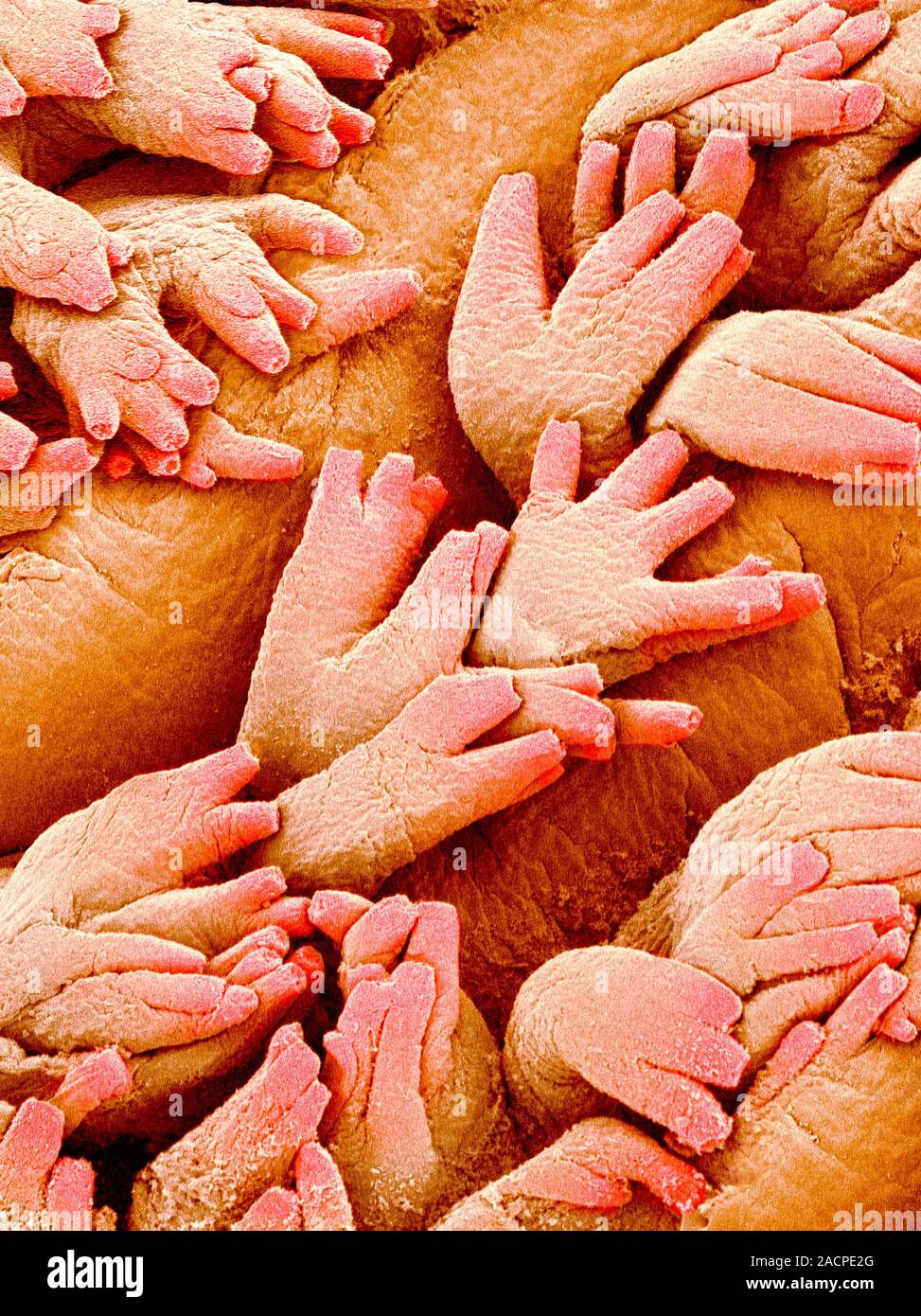 Fish mouth lining. Coloured scanning electron micrograph of the lining ...