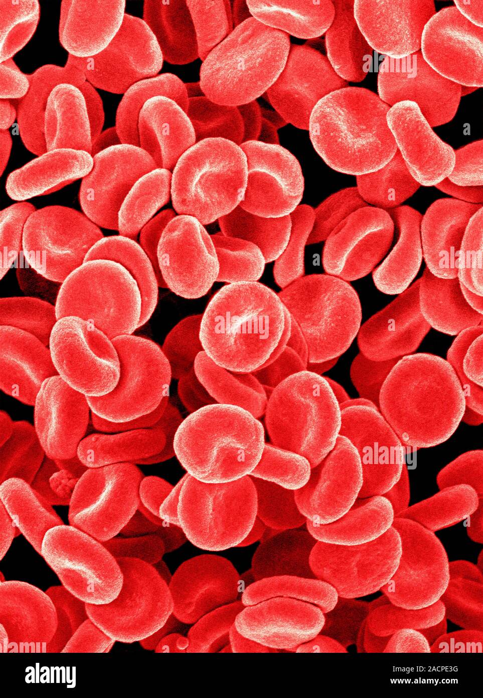 Red blood cells. Coloured scanning electron micrograph (SEM) of human ...