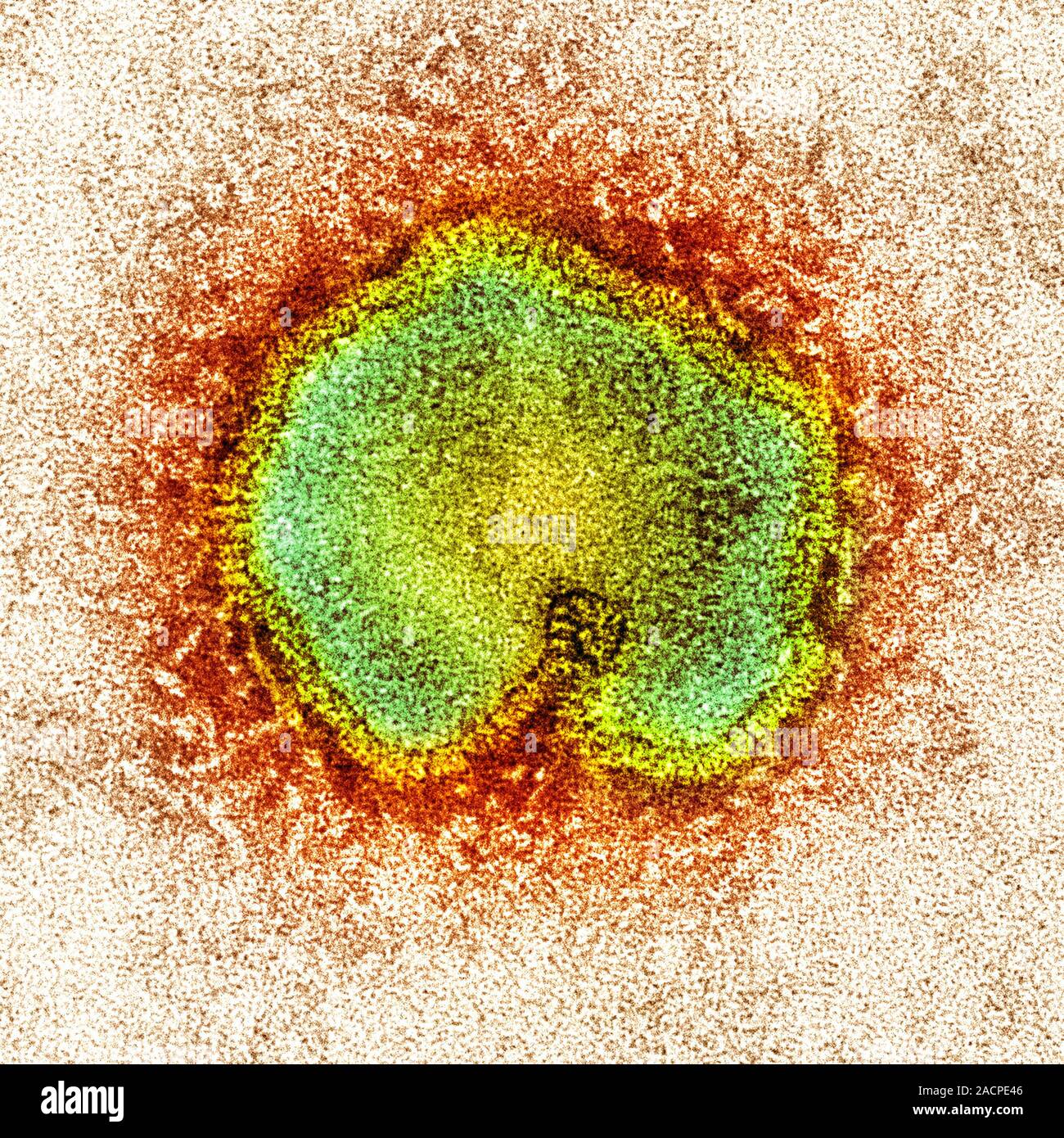 Avian influenza virus, type A strain H7N9, coloured transmission ...