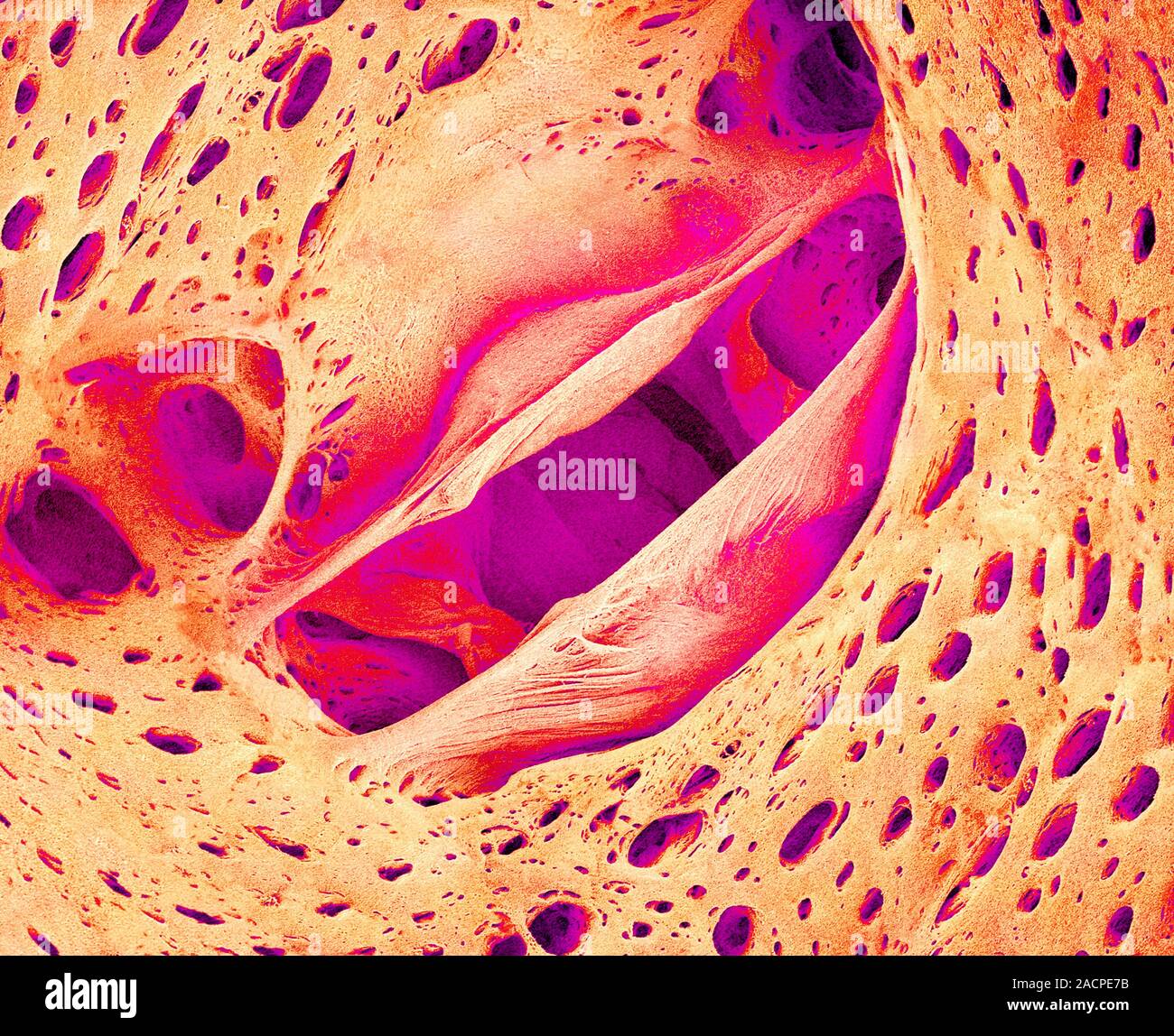 Fish heart valve. Coloured scanning electron micrograph (SEM) of a view ...