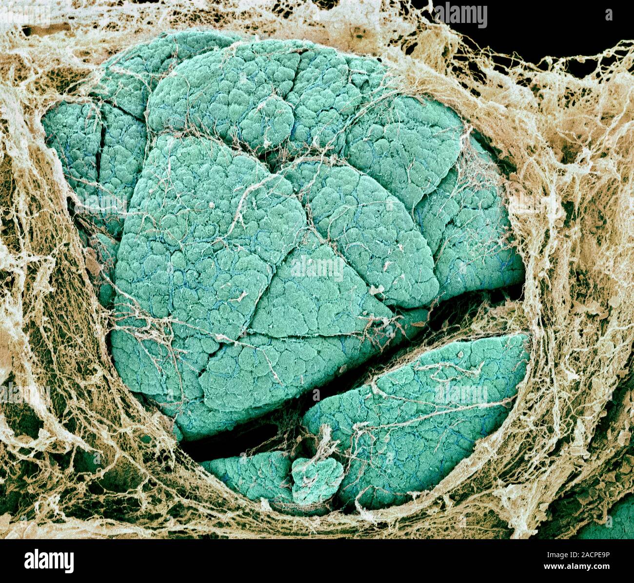 Pancreas lobes, coloured scanning electron micrograph (SEM). Several ...