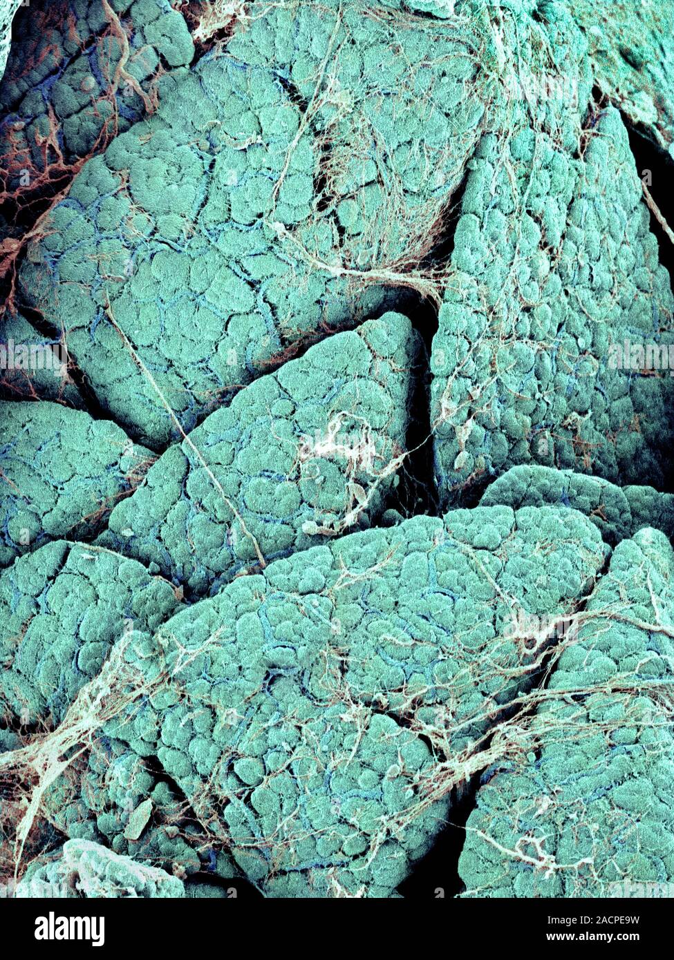 Pancreas lobes, coloured scanning electron micrograph (SEM). Several ...
