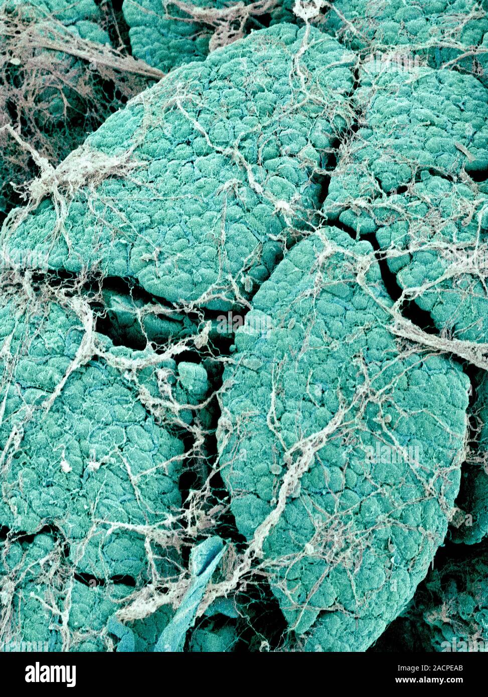 Pancreas lobes, coloured scanning electron micrograph (SEM). Several ...