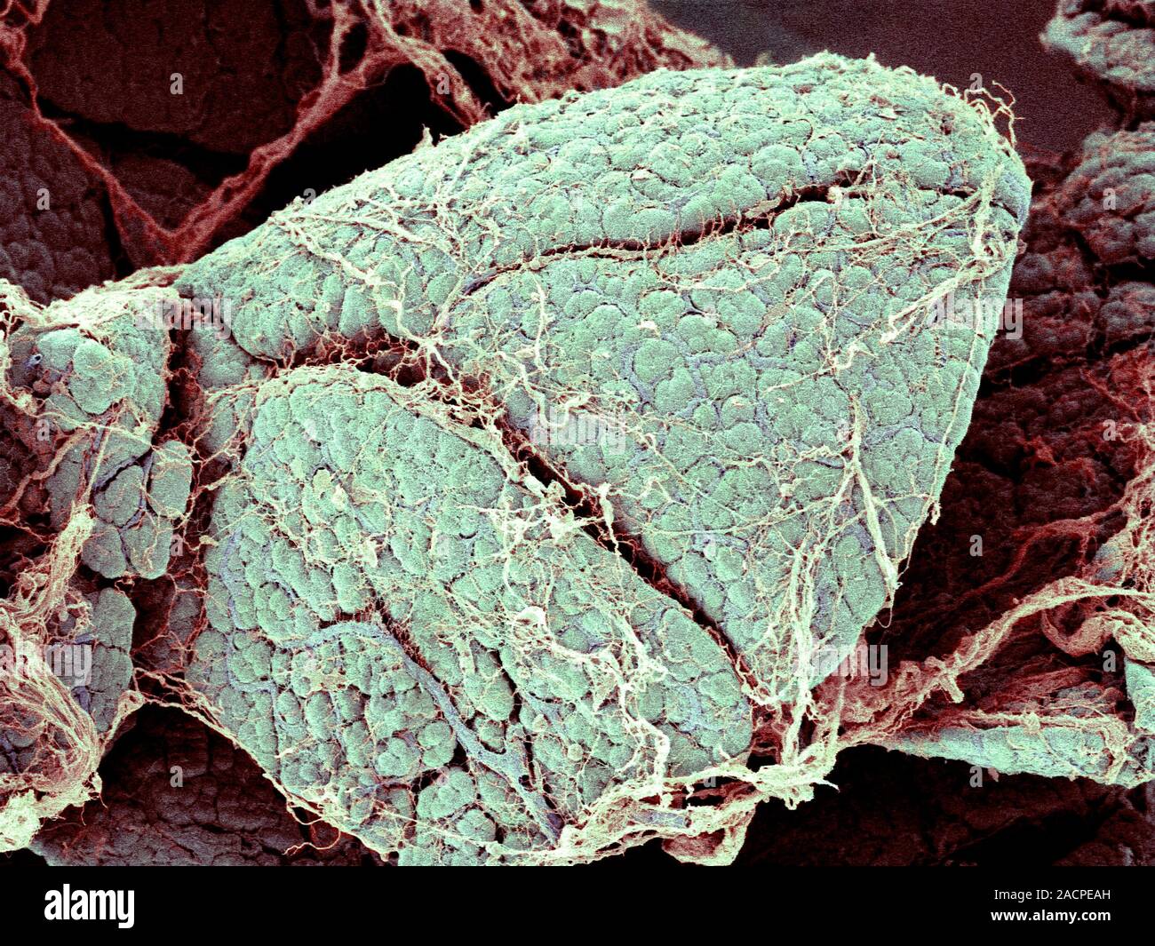 Pancreas lobes, coloured scanning electron micrograph (SEM). Several ...