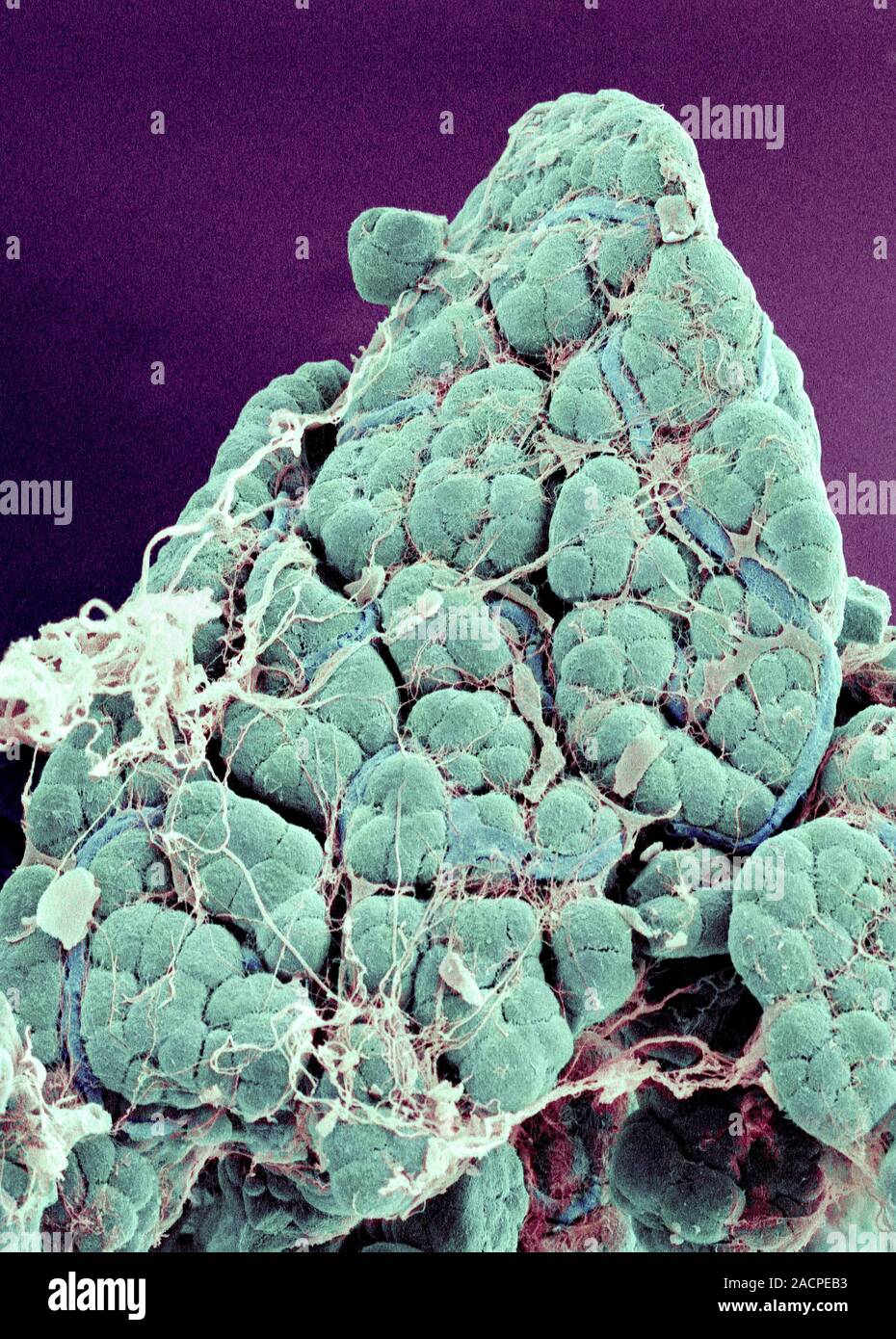 Pancreas cells, coloured scanning electron micrograph (SEM). The small ...