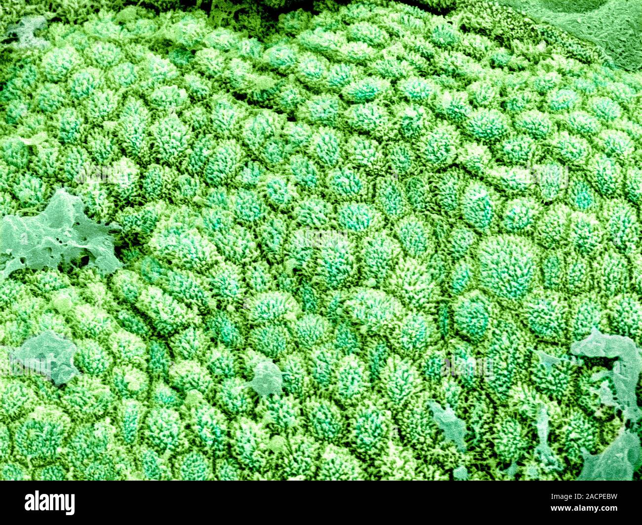 Gallbladder surface, coloured scanning electron micrograph (SEM). The ...
