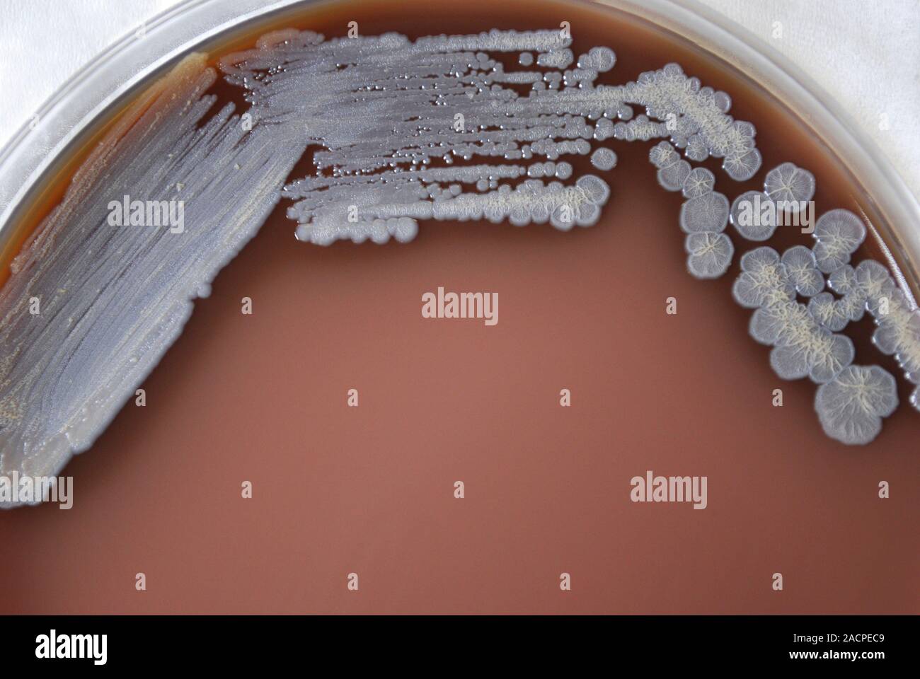 Burkholderia pseudomallei bacteria, petri dish culture. This Gram ...