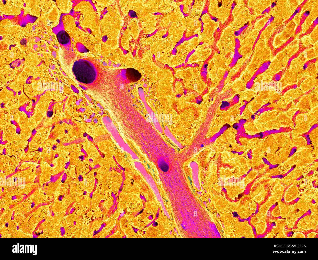 Liver vein. Coloured scanning electron micrograph (SEM) of liver tissue ...