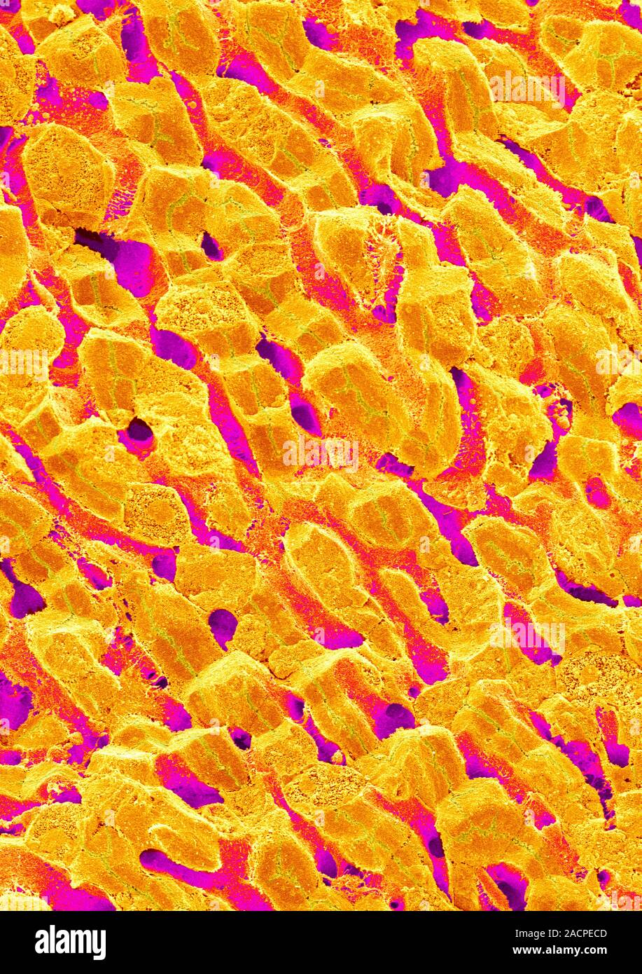 Liver vein. Coloured scanning electron micrograph (SEM) of liver tissue ...