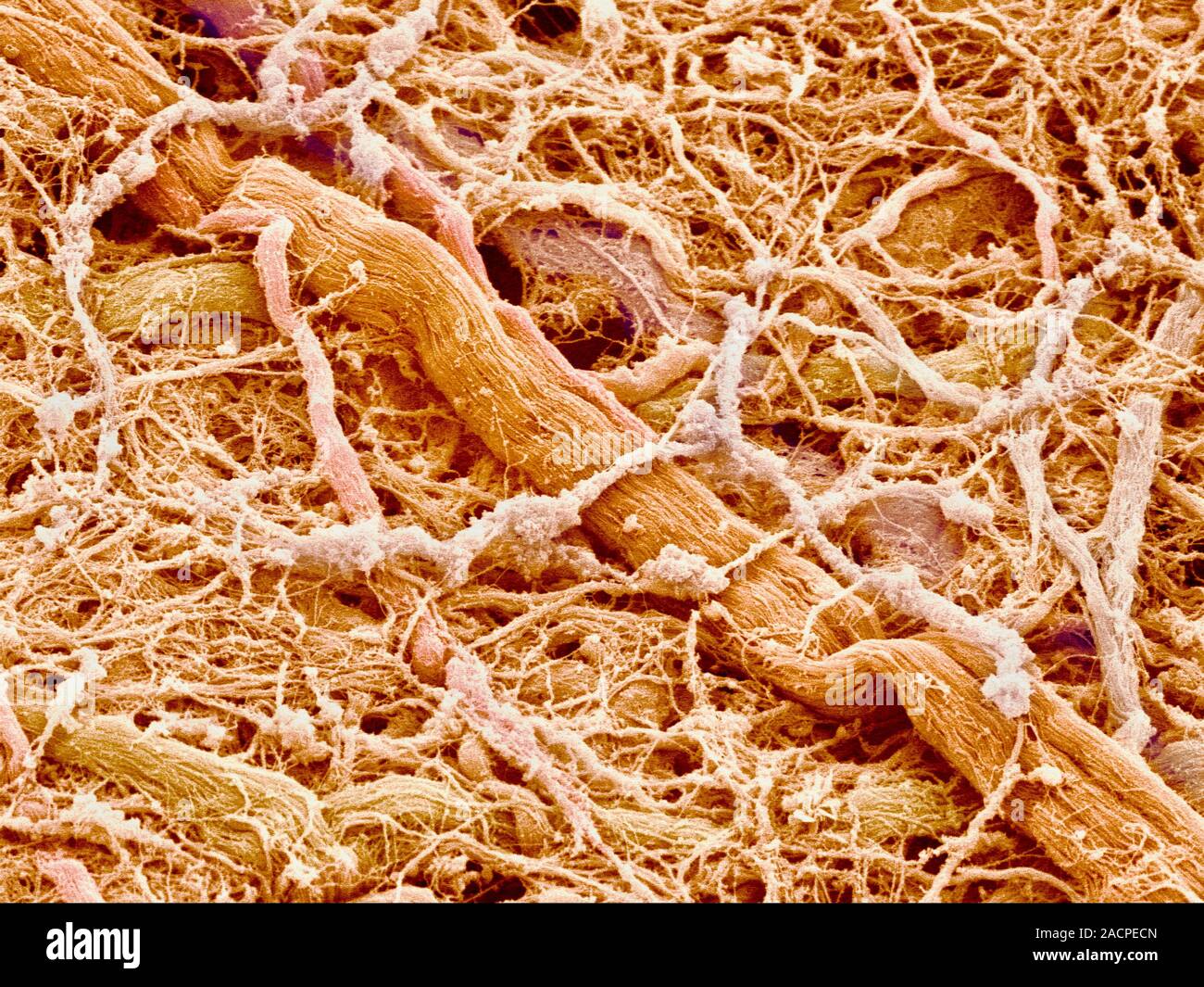 Connective tissue. Coloured scanning electron micrograph (SEM) of ...