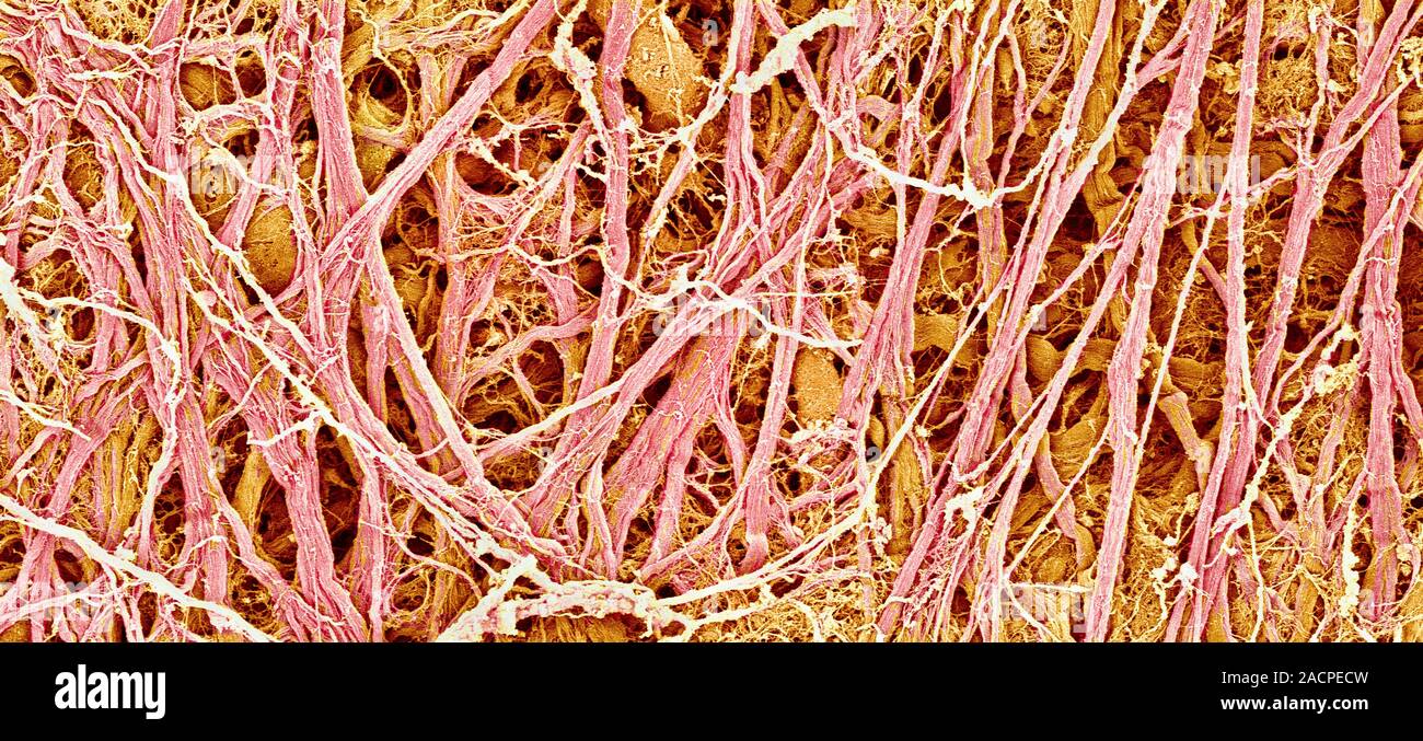 Connective tissue. Coloured scanning electron micrograph (SEM) of ...