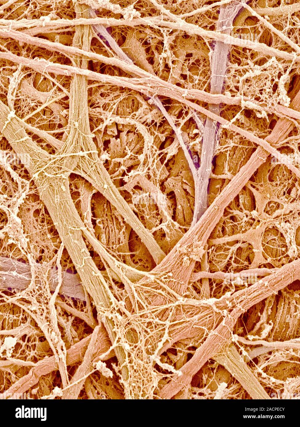 Connective tissue. Coloured scanning electron micrograph (SEM) of ...