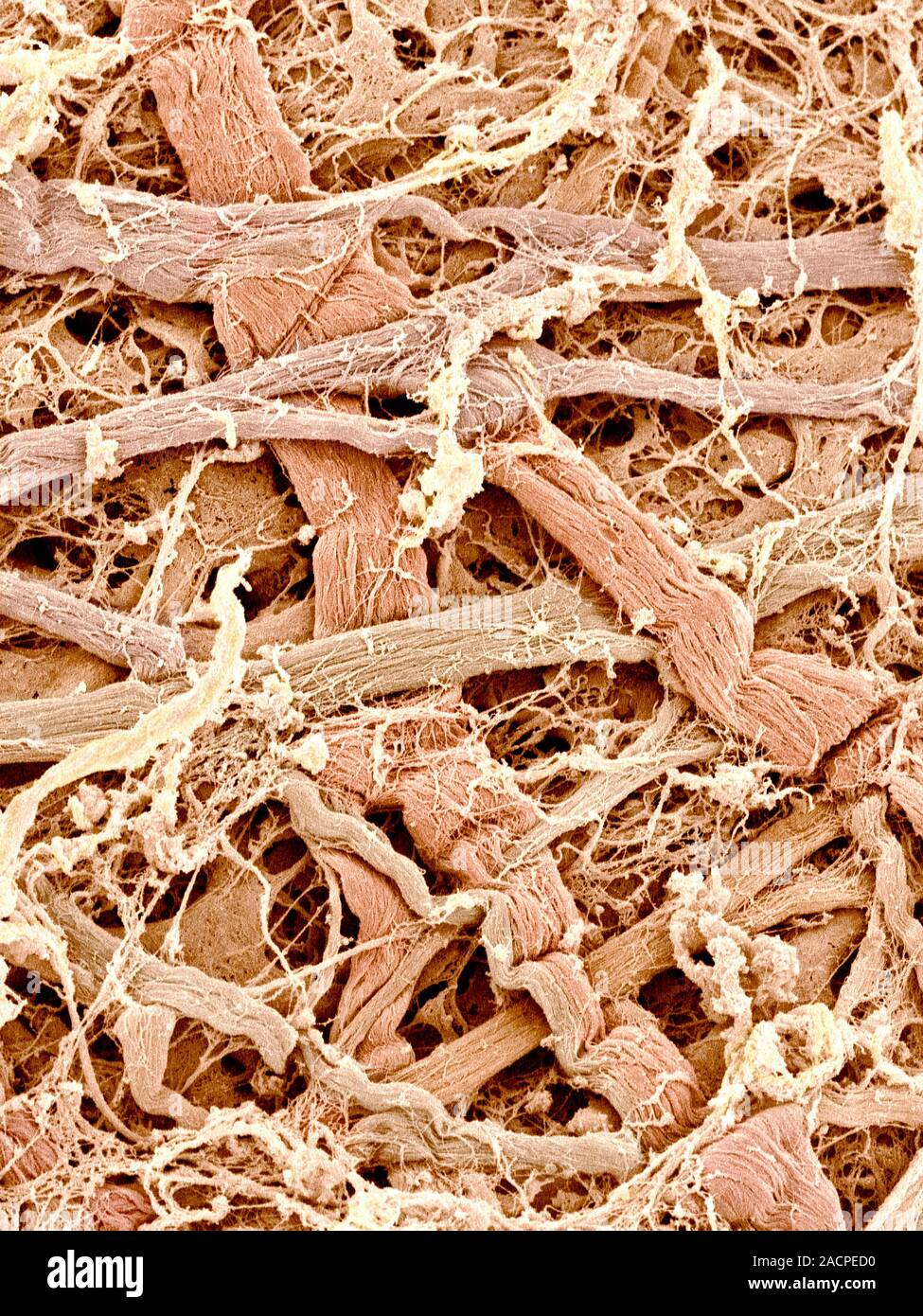 Connective tissue. Coloured scanning electron micrograph (SEM) of ...