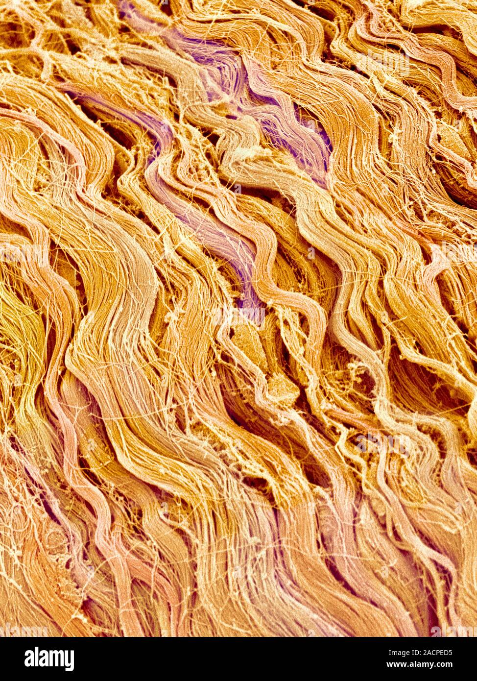 Connective tissue. Coloured scanning electron micrograph (SEM) of ...