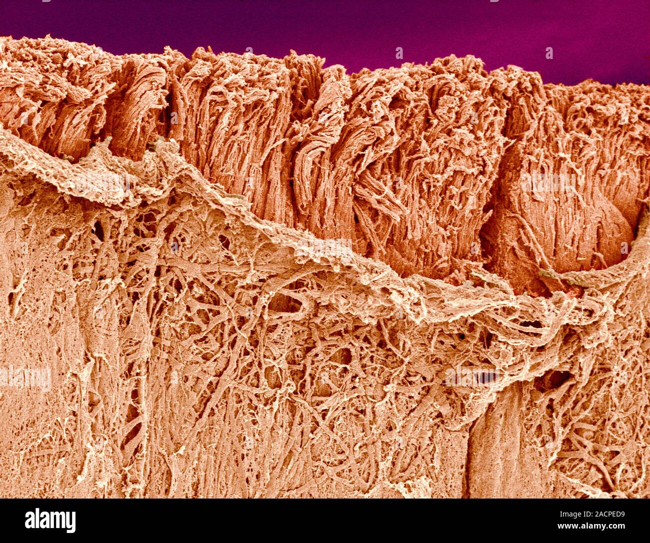 Trachea muscle. Coloured scanning electron micrograph (SEM) of smooth ...